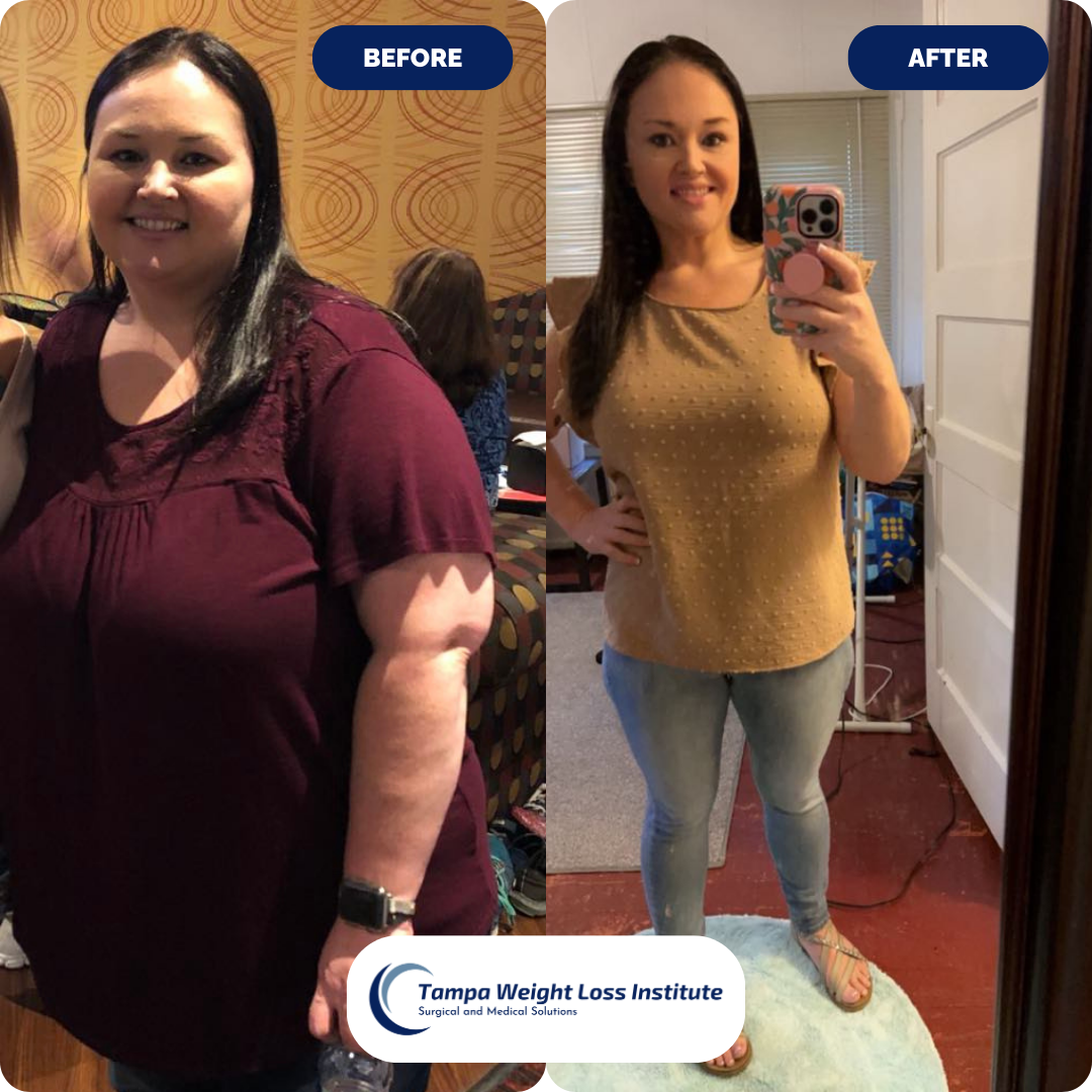 Amit Taggar MD - Tampa Weight Loss Institute