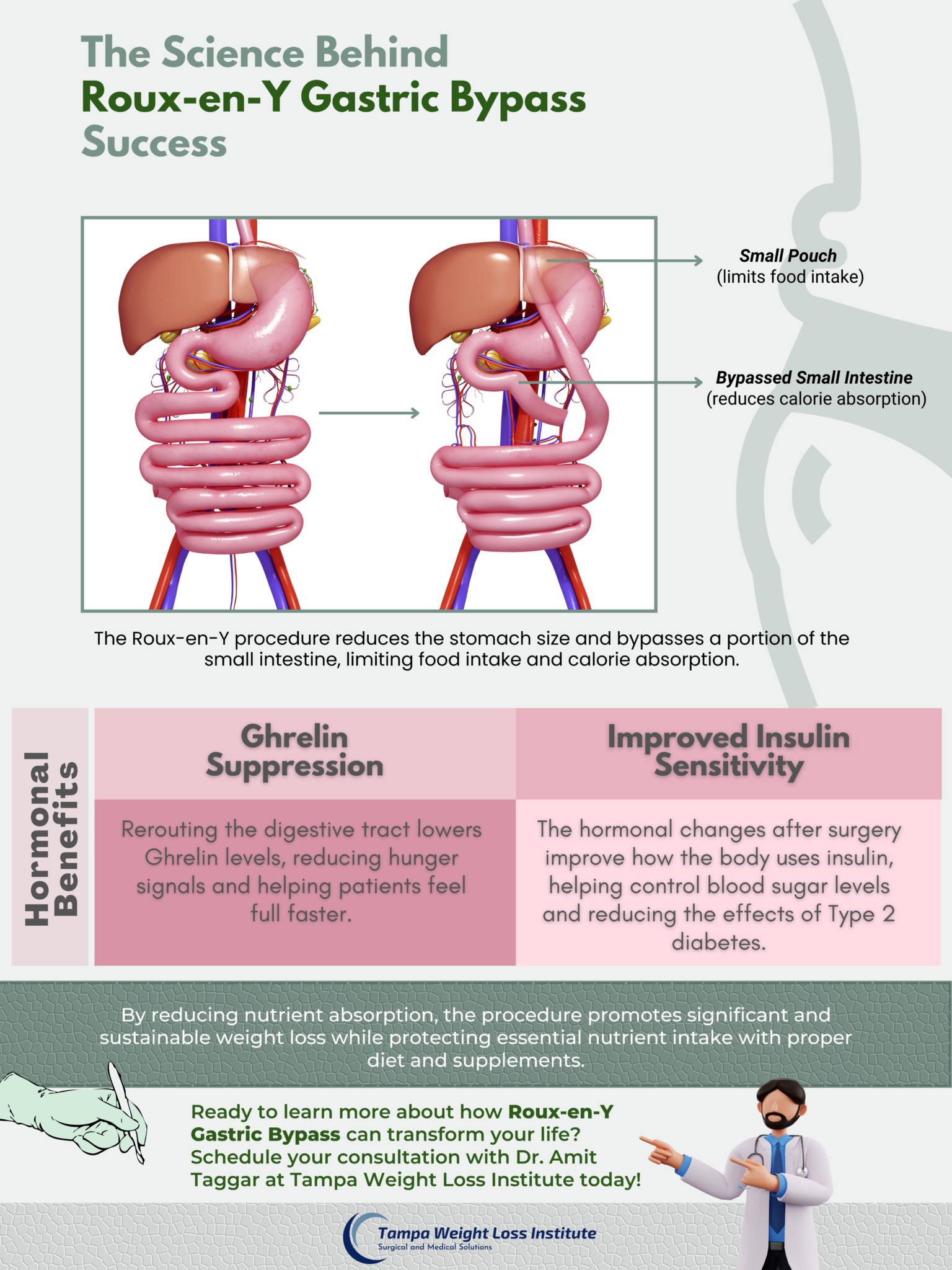 The Advantages of Roux-en-Y Gastric Bypass - Tampa Weight Loss Institute